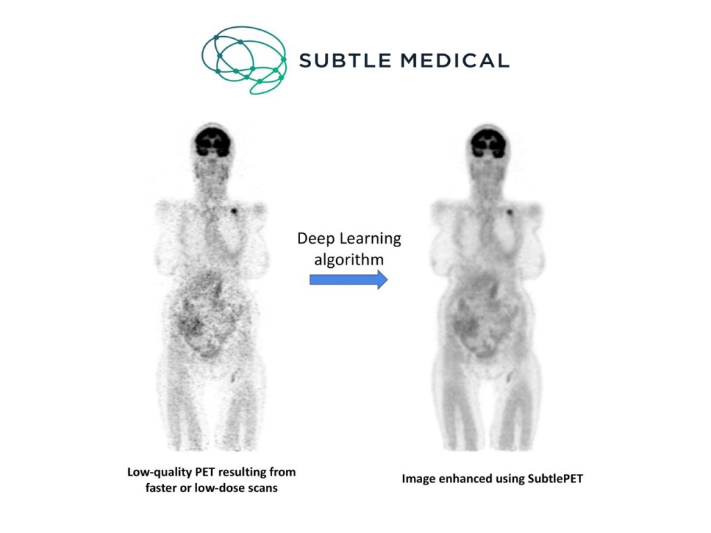 Subtle Medical - Deep Learning boosts healthcare. Faster, Safer, Smarter.