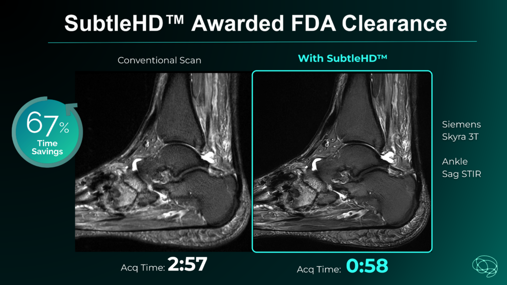 Subtle Medical - Deep Learning boosts healthcare. Faster, Safer, Smarter.